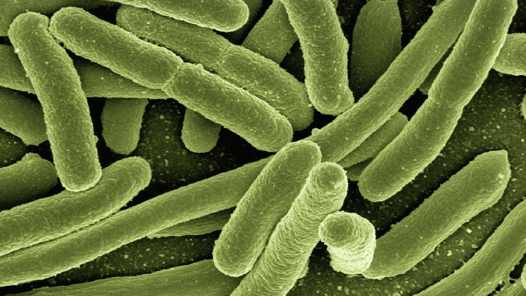 Harmless or deadly? Examining the evolution of E. coli - Scimex