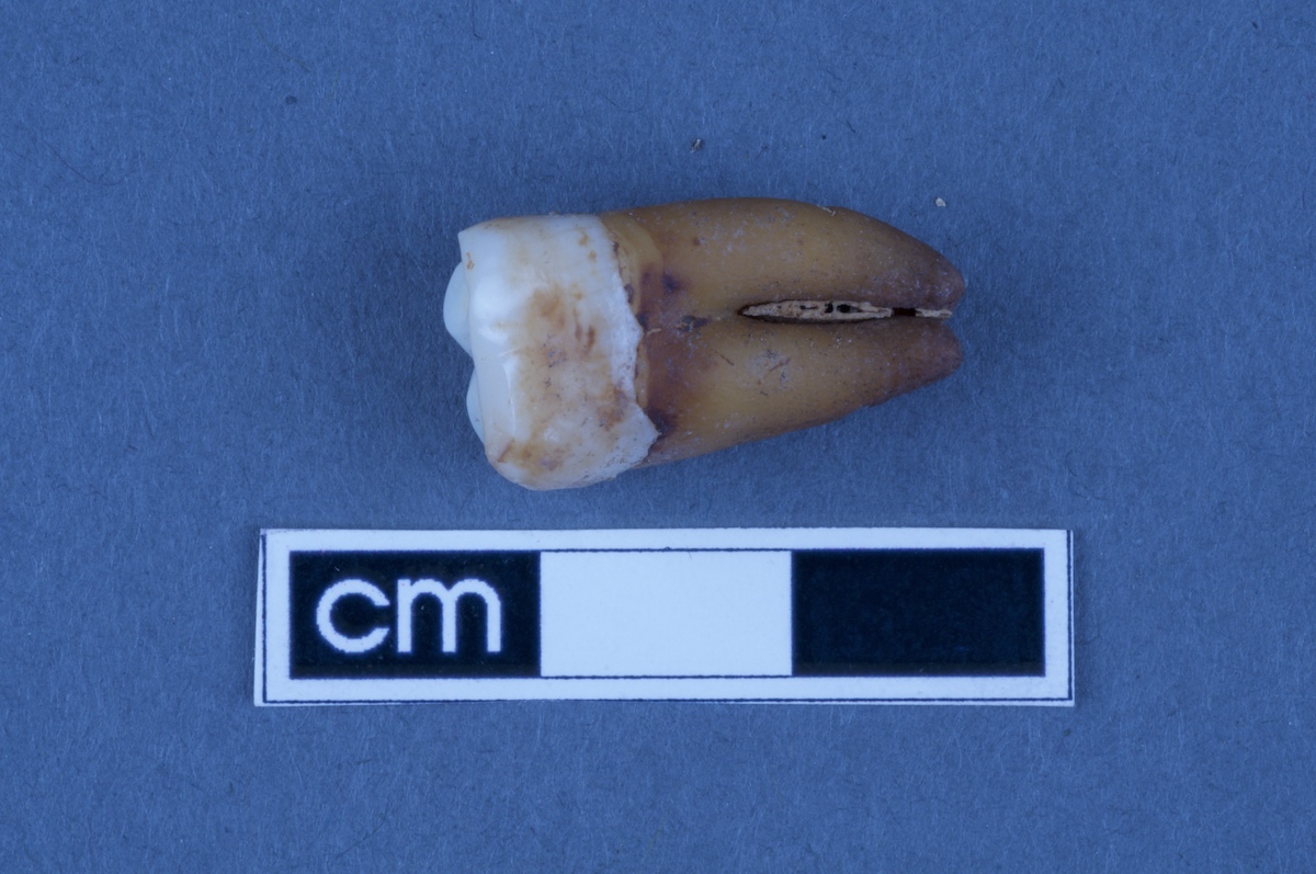 Tooth isotopes offer window into South Australia’s early colonial ...