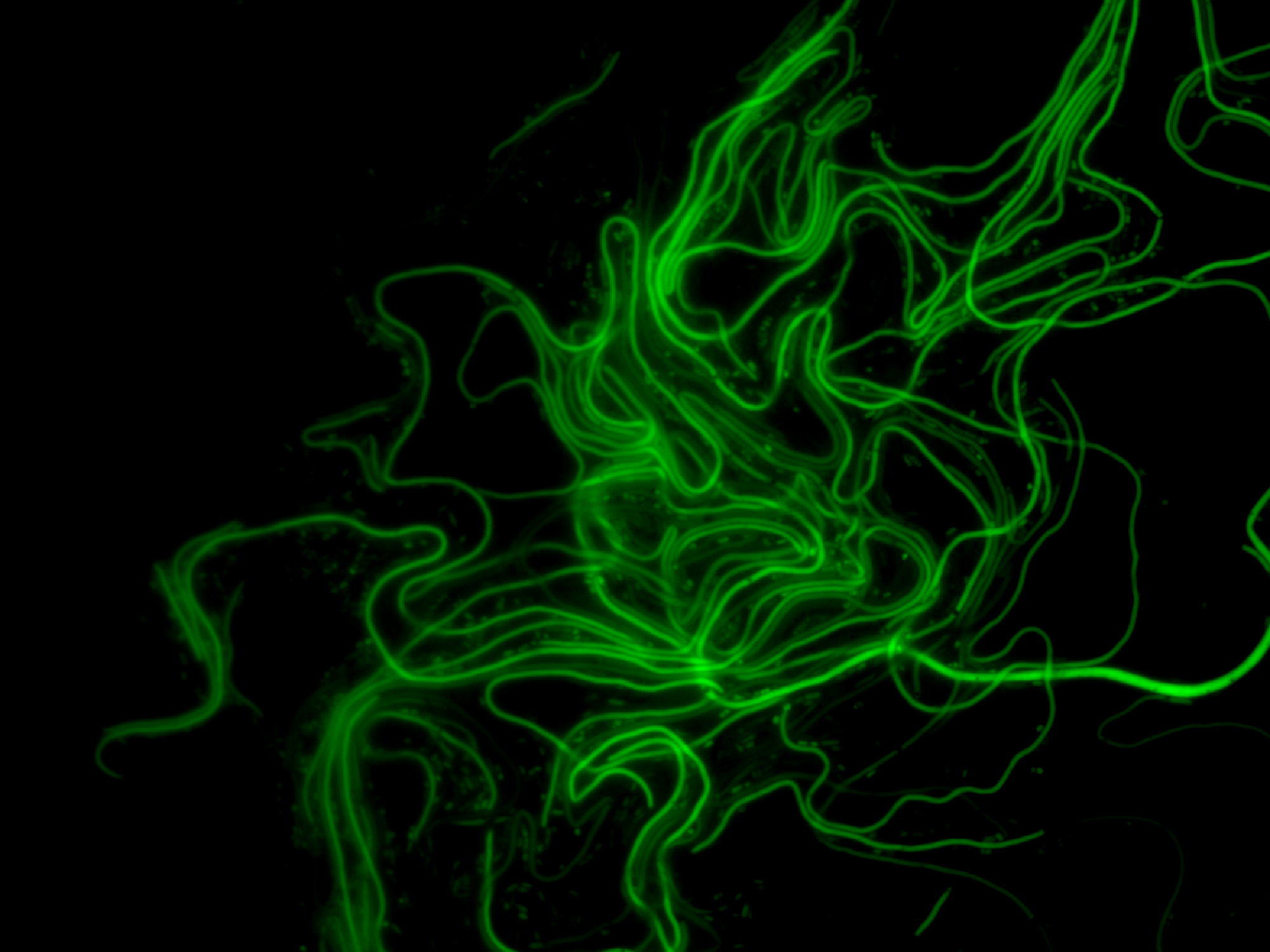 Bacteria’s shapeshifting behaviour offers clue to future UTI treatments ...