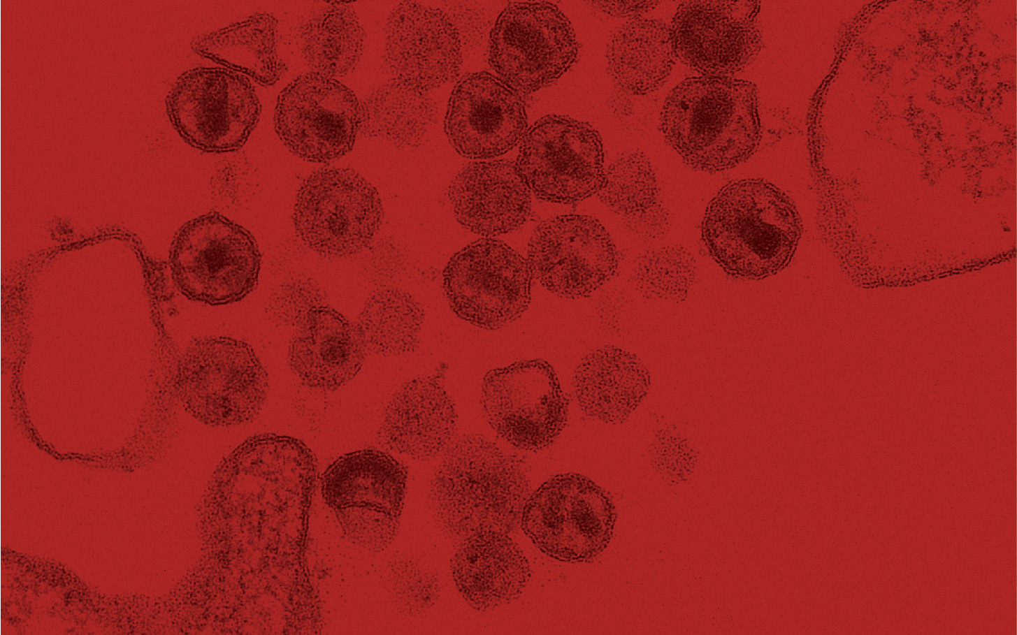 Australia records lowest ever HIV numbers, but late diagnoses are ...