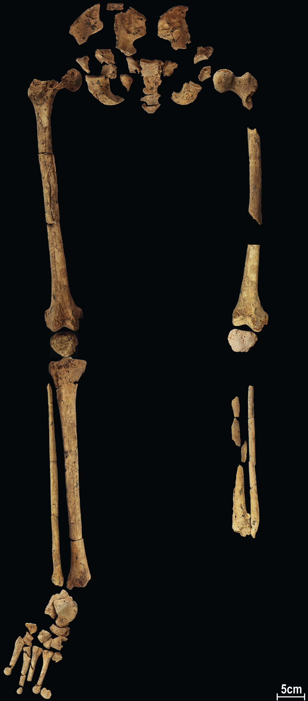 NEWS BRIEFING: Earliest known Stone Age surgery discovered - Scimex