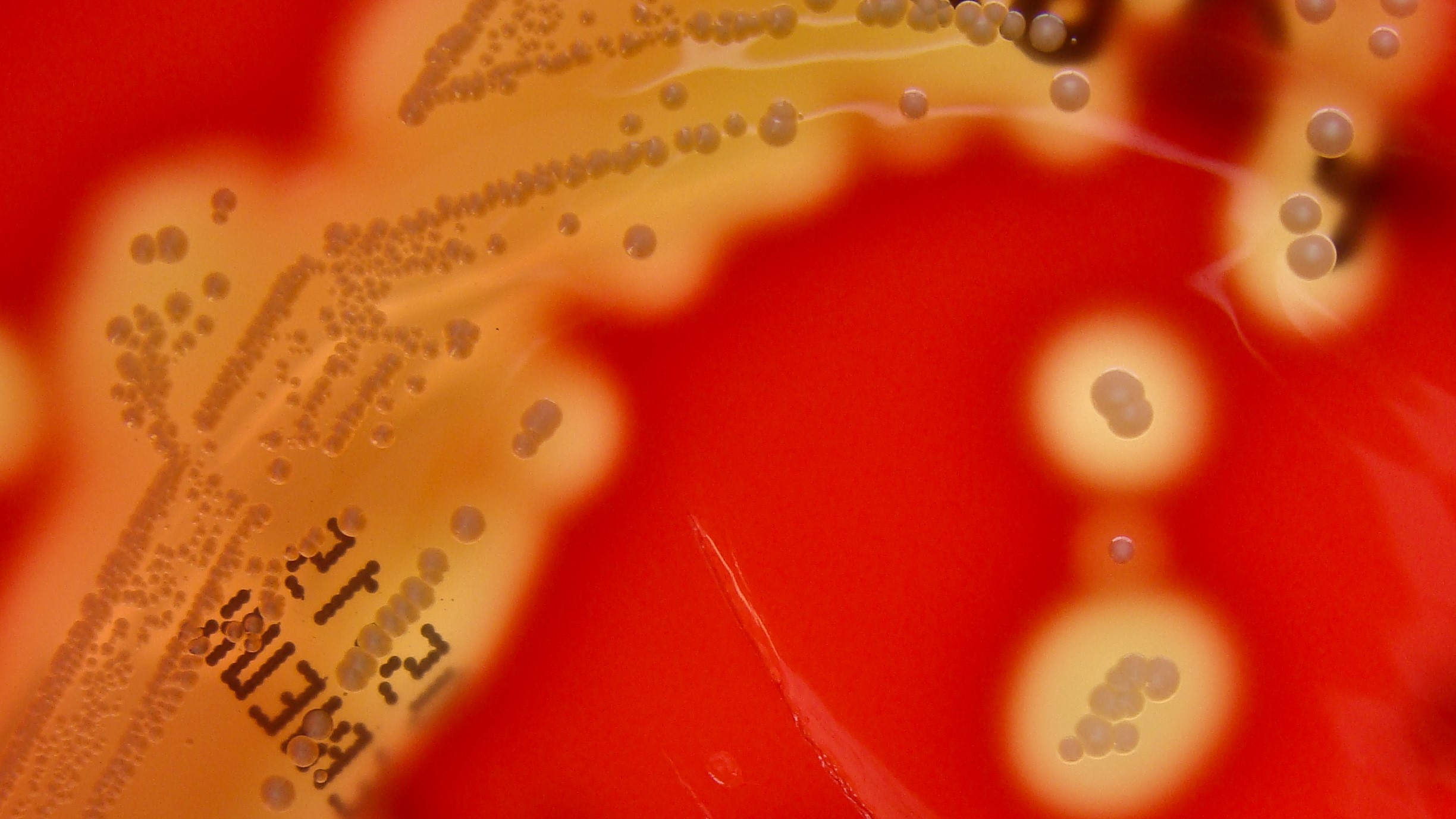 NEWS BRIEFING: Sneaky superbugs - Scientists find a new way bacteria ...