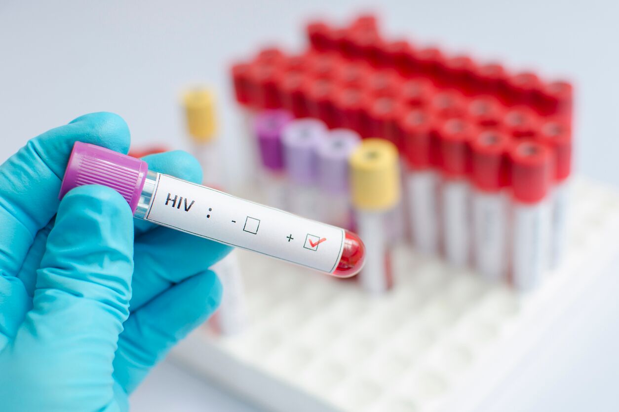 EXPERT REACTION: HIV remission observed in second-ever patient - Scimex