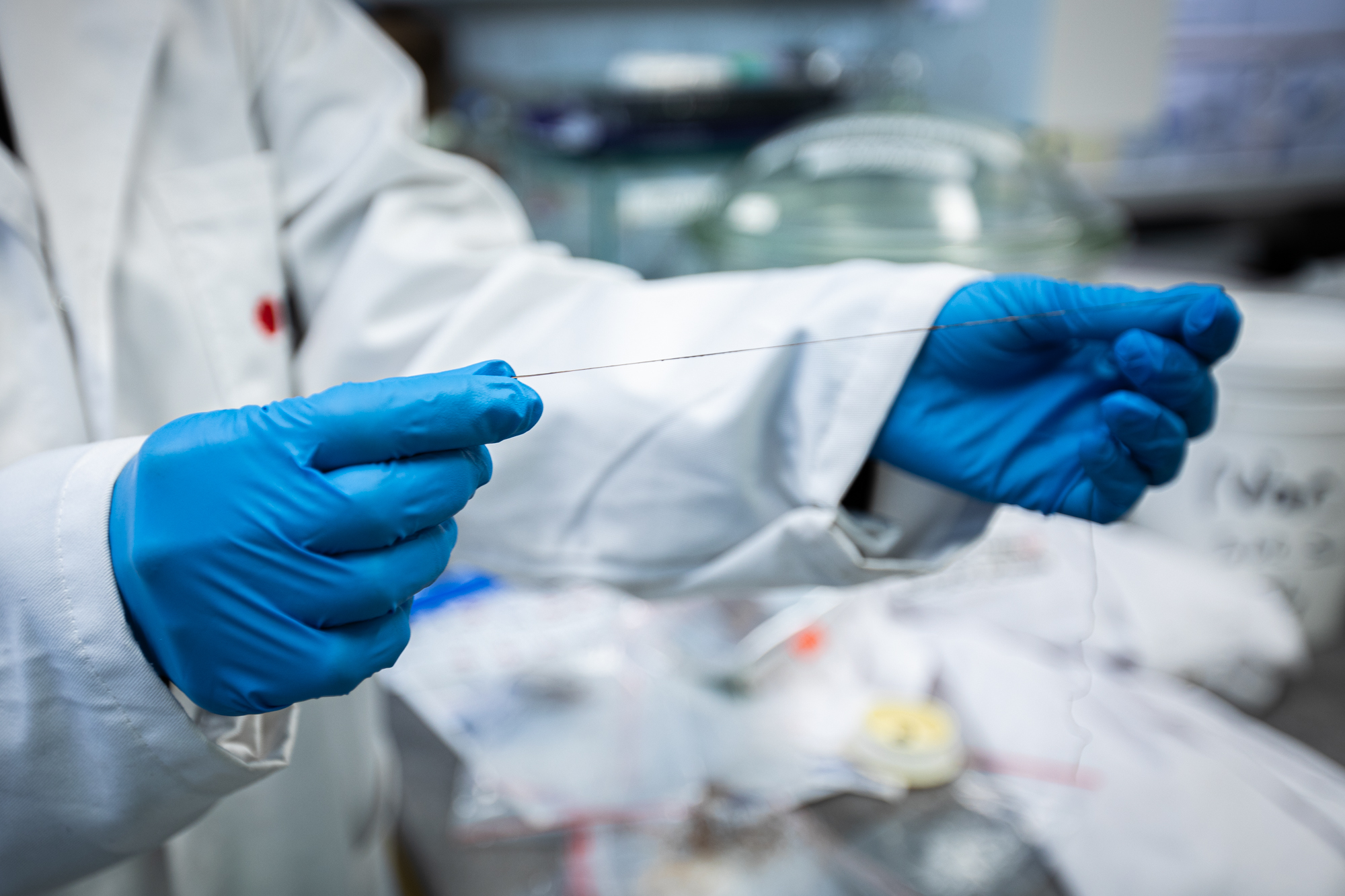 Smart stitches to reduce infection and simplify post op monitoring - Scimex