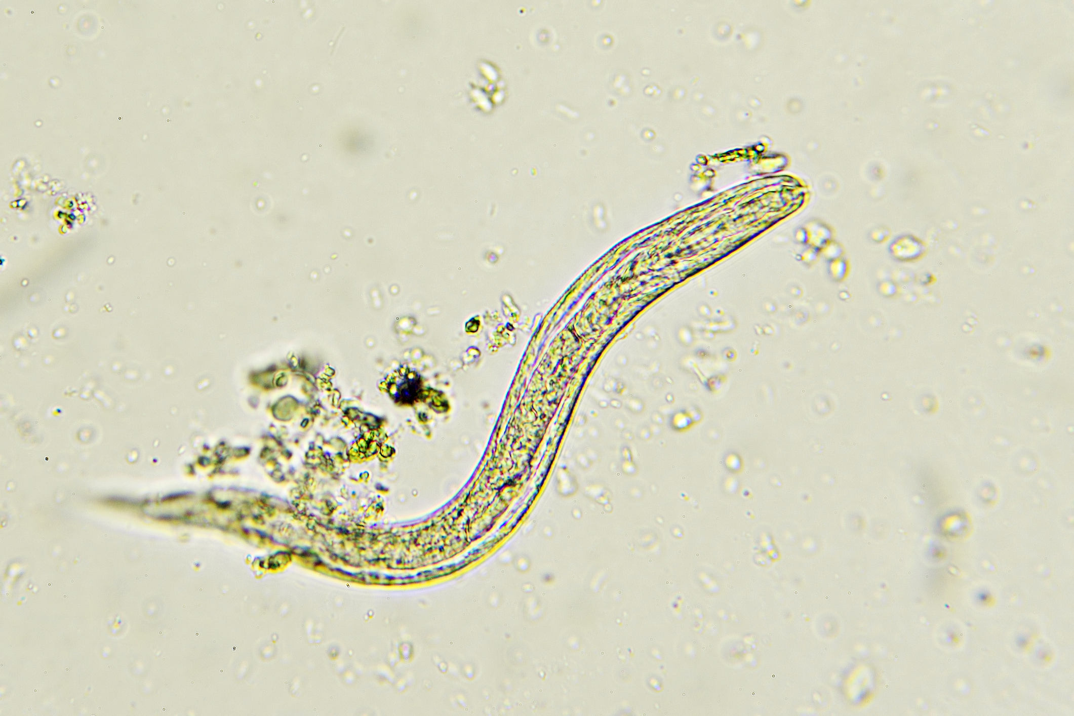 Campaign aims to understand and stamp out dangerous parasitic worm ...