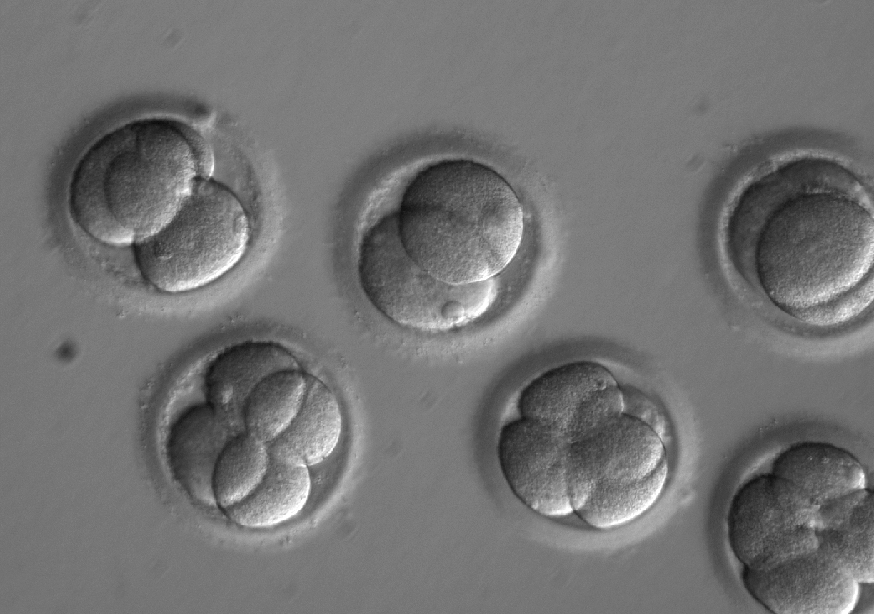 EXPERT REACTION: CRISPR used in human embryos - Scimex