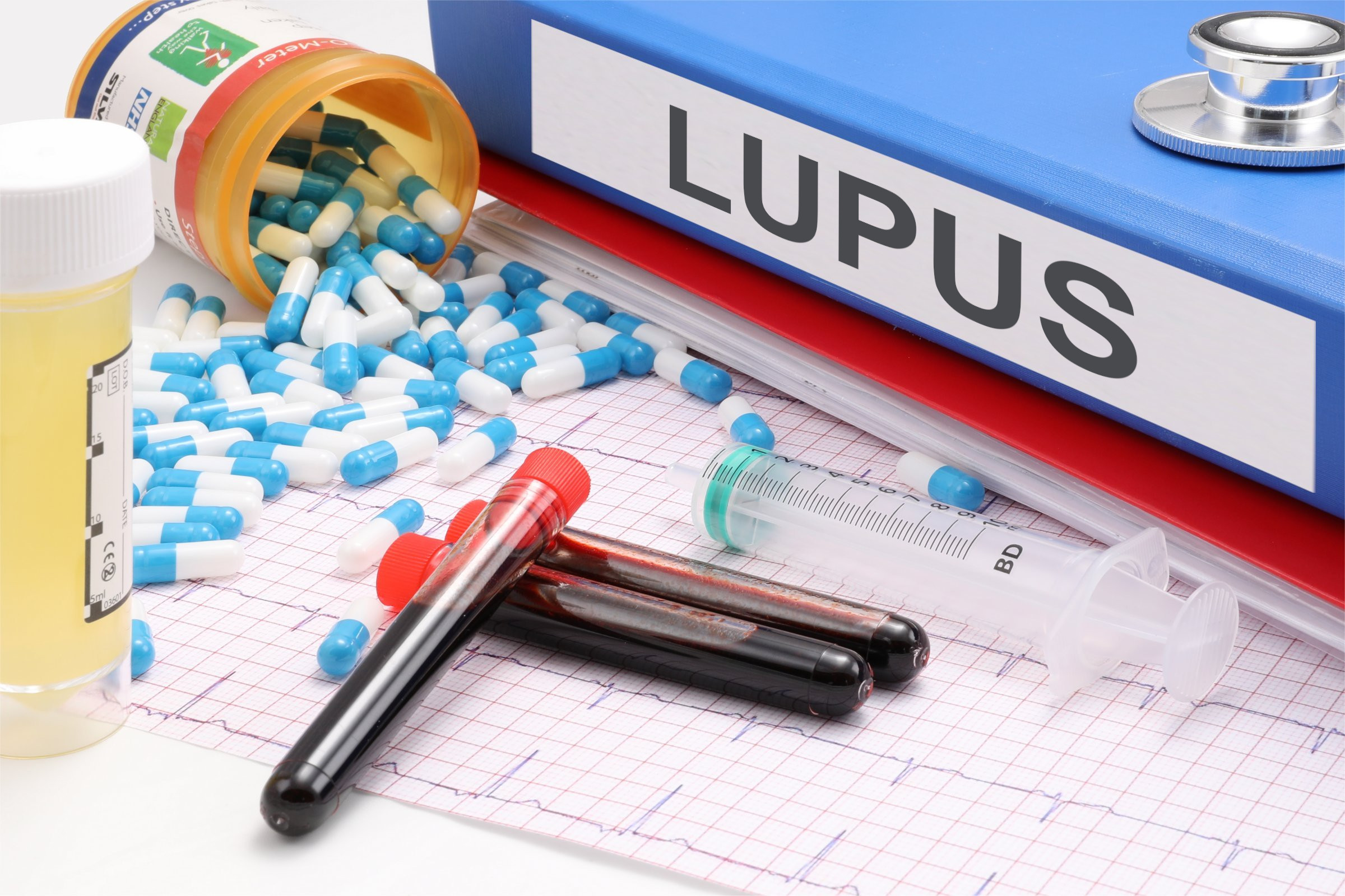 Five lupus patients in 17-month remission after CAR T therapy - Scimex