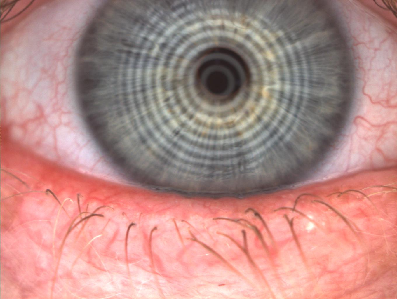 ‘Dry eye’ increasing from mask use: Free resource to help - Scimex