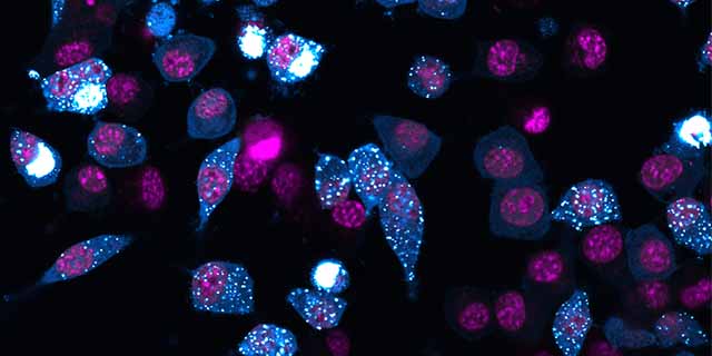 How protein aggregation occurs in cells - Scimex