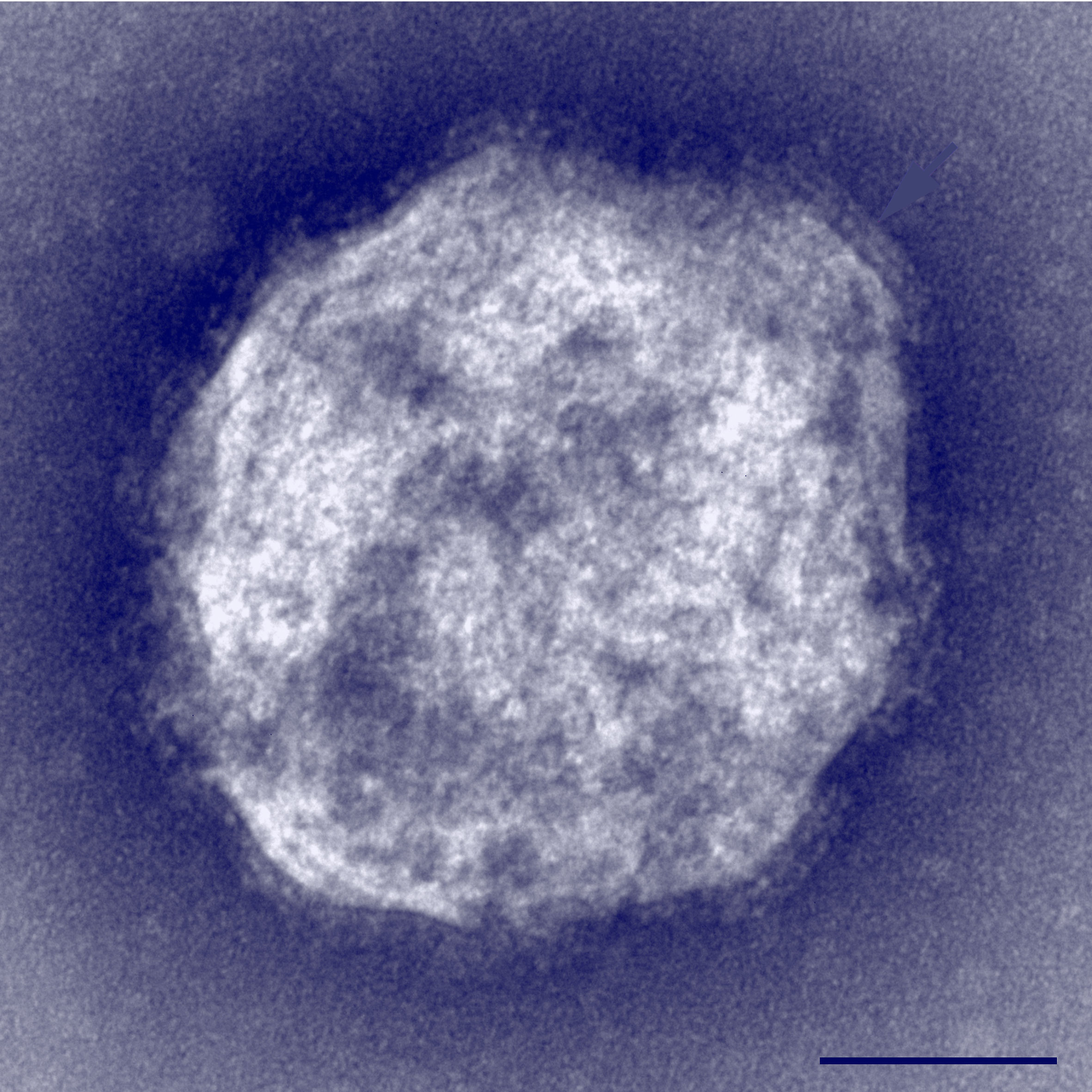 Discovery of new Hendra virus variant example of being proactive on ...