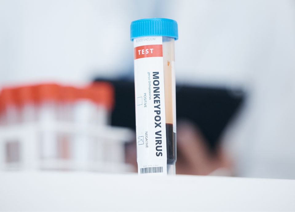 Unveiling Australia’s fastest next-gen mpox diagnostic tool - Scimex