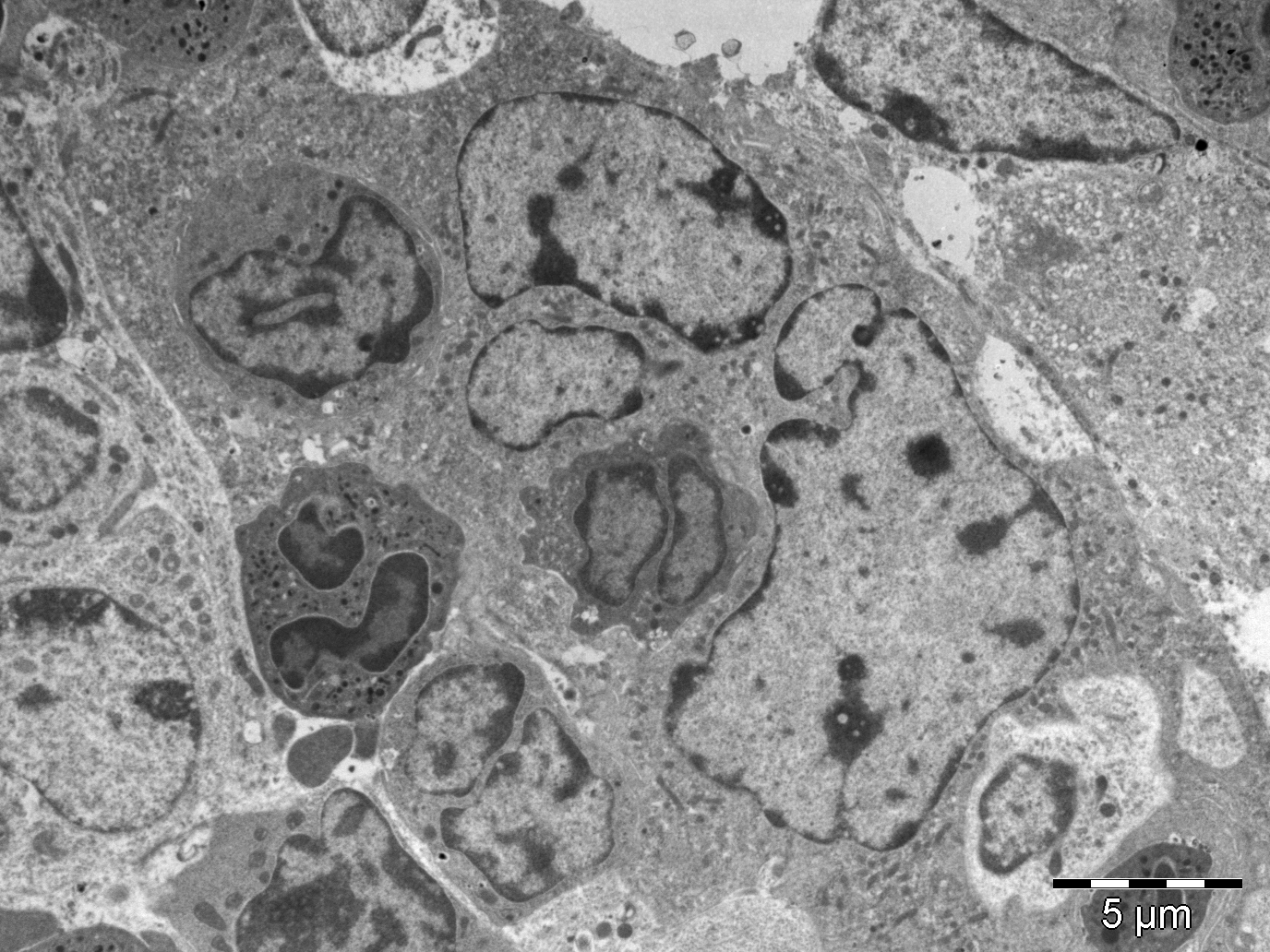 Key to platelet production advances understanding of RNA - Scimex