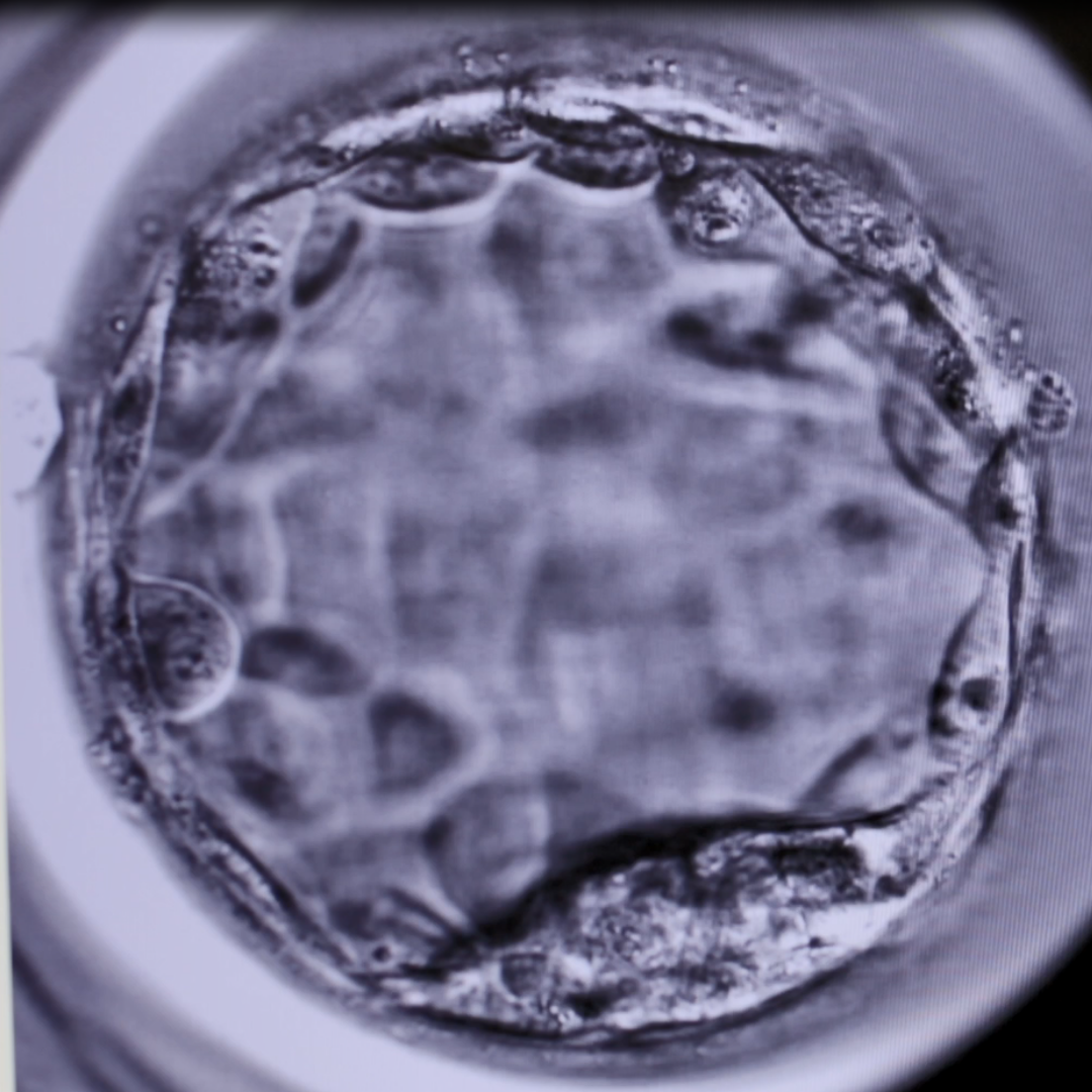 Nature’s way is best, even when it comes to IVF - Scimex