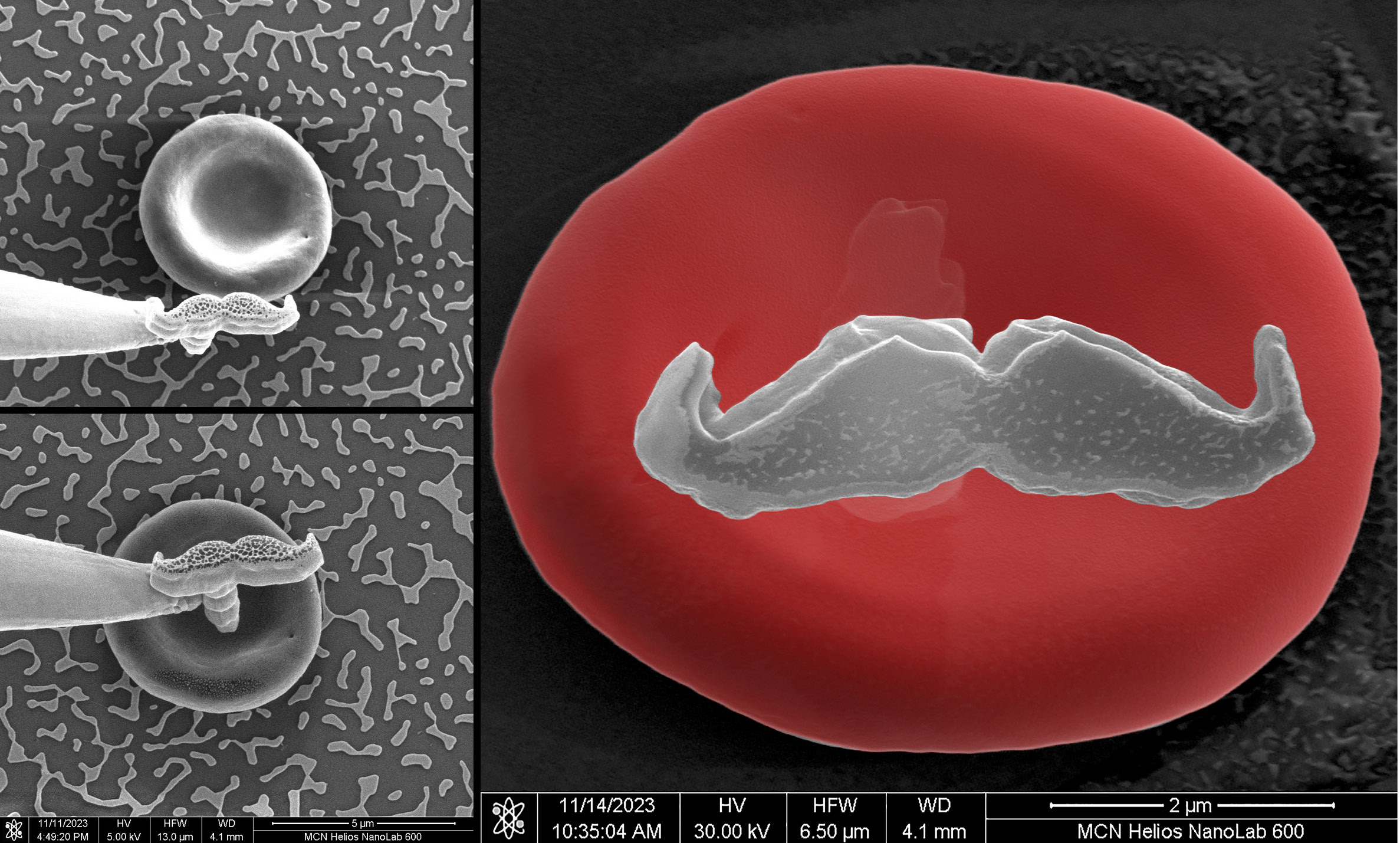 Australian scientists give red blood cell world’s tiniest Mo - Scimex
